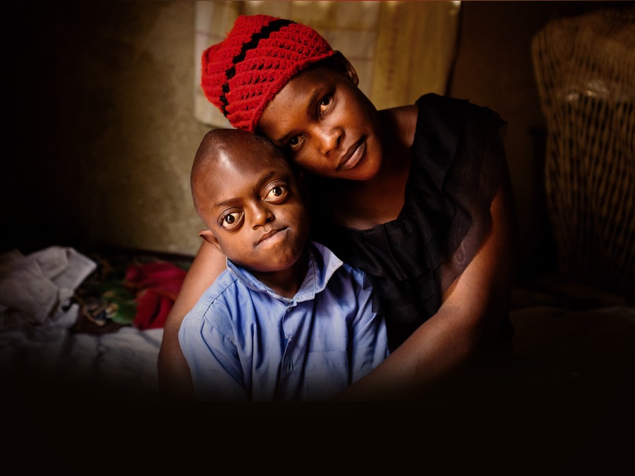 Body Bizarre - Apple TV (NO)