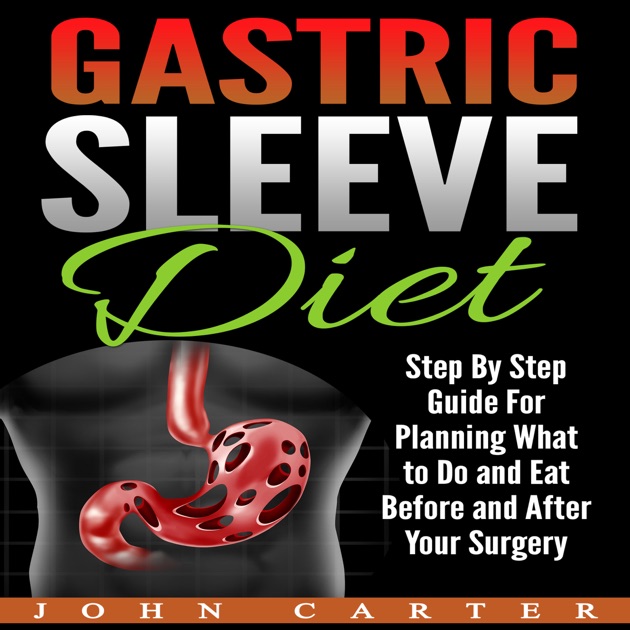 Gastric Sleeve Diet Step By Step Guide For Planning What To Do And Eat Before And After Your