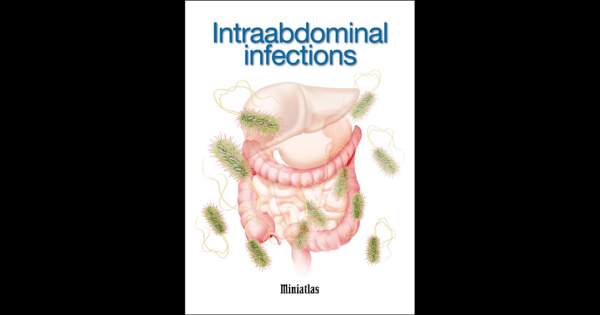 Intraabdominal Infections By Luis Raúl Lépori On Ibooks
