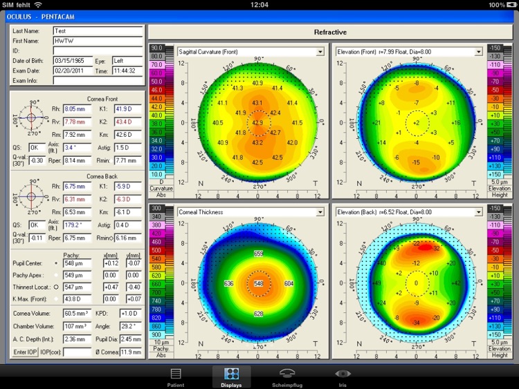 Pentacam Viewer by OCULUS Optikgeraete GmbH