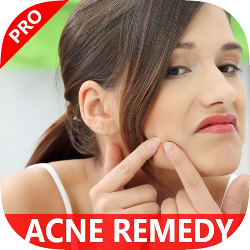 Learn How To Get Rid Of Pimples Fast - Best Natural ACNE Cure Treatment ...