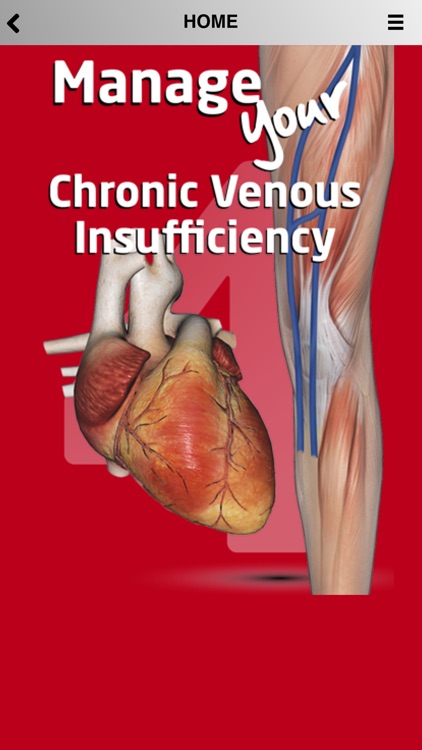 Manage your Chronic Venous Insufficiency 4 by Epat