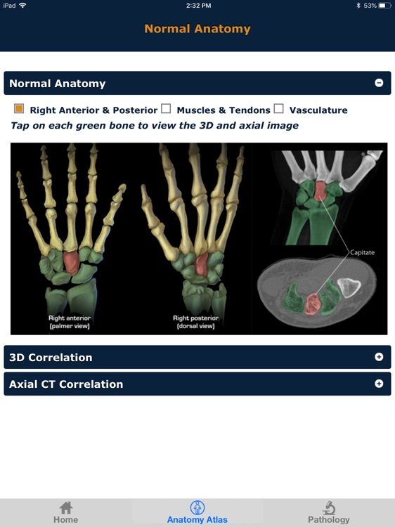 CTisus: CT of the Hand & Wrist by Elliot Fishman
