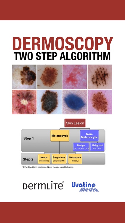 Dermoscopy Two Step Algorithm by Usatine & Erickson Media LLC