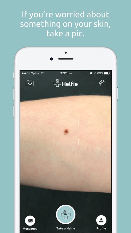 Helfie - Prevent Skin Cancer by HELFIE PTY LTD