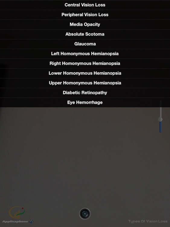 Types Of Vision Loss by Raqaya Saeed