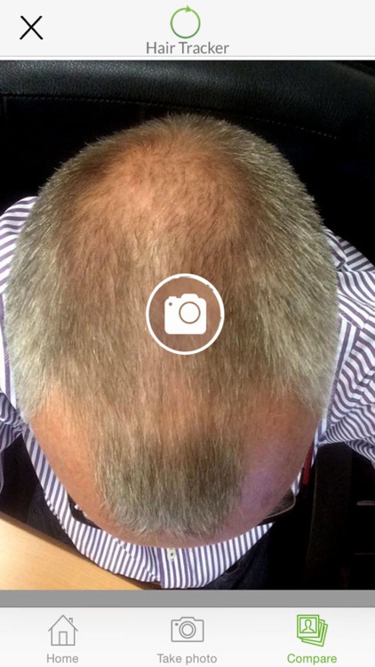 Hair Growth Tracker by Image Review Concepts Pty. Ltd.