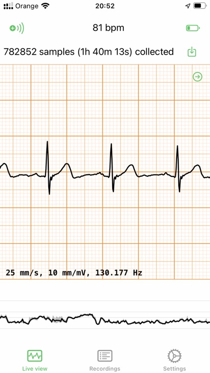 ECG EKG Viewer for Polar H10 by Hvin Oü